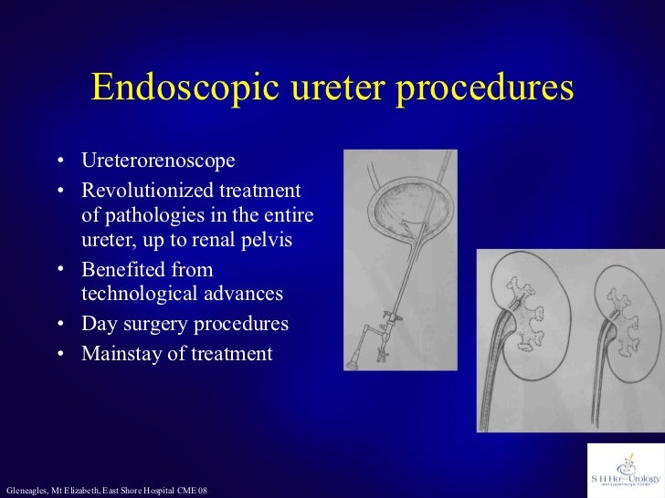 What is New In Minimally Invasive Surgery for Urology