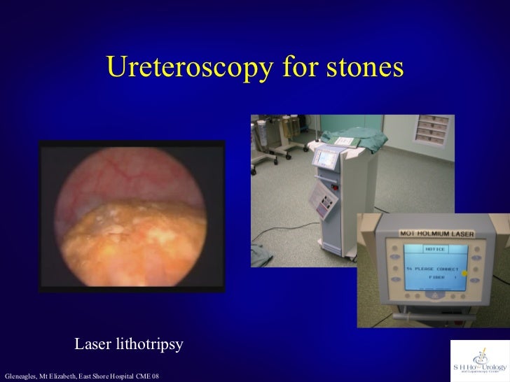 What is New In Minimally Invasive Surgery for Urology