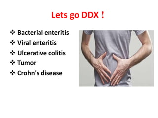 Crohns disease | PPTX