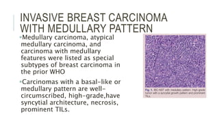WHAT’S NEW IN BREAST PATHOLOGY 2022.pptx | Cancer | Diseases and Conditions