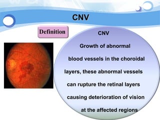 CNV updates | PPT