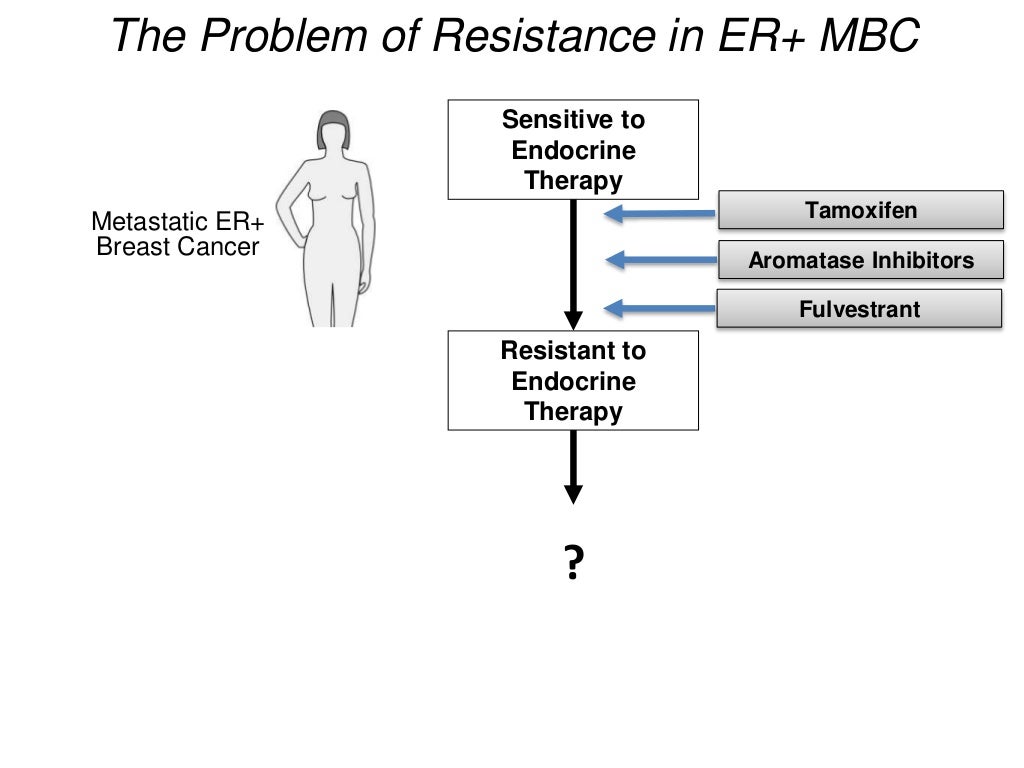 Whats New In Research For Er Metastatic Breast Cancer