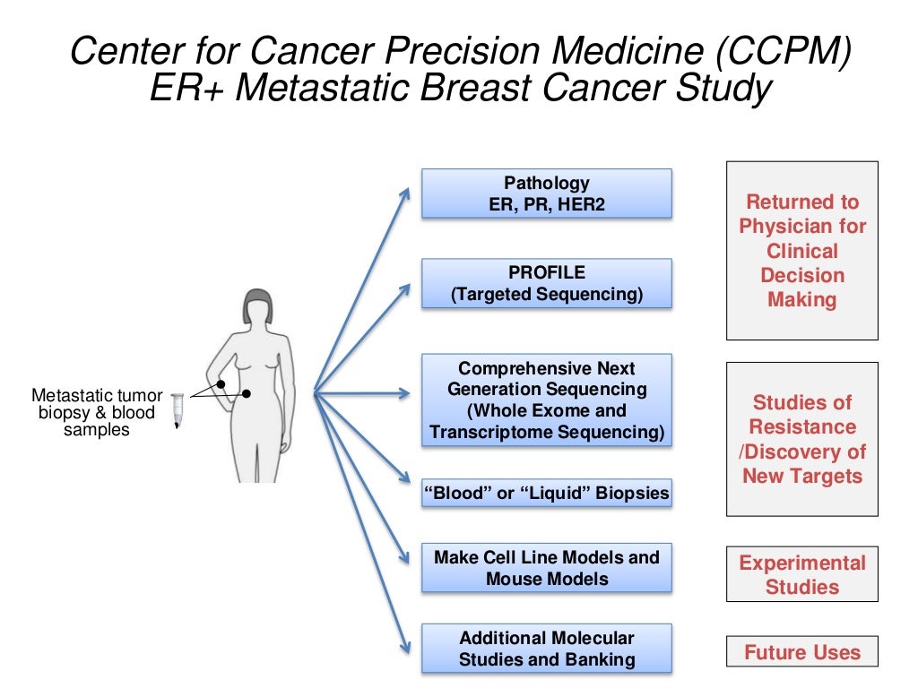 Whats New In Research For Er Metastatic Breast Cancer
