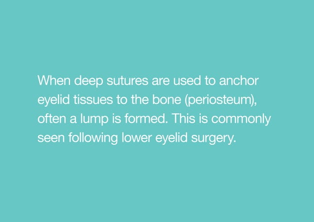 What To Do If Tiny Bumps Form After Eyelid Surgery | PPT