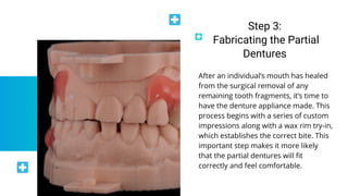 What to expect when getting partial dentures. | PPT