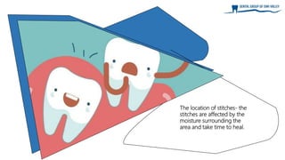 What to Know About Dissolvable Stitches After Wisdom Teeth Removal | PPT