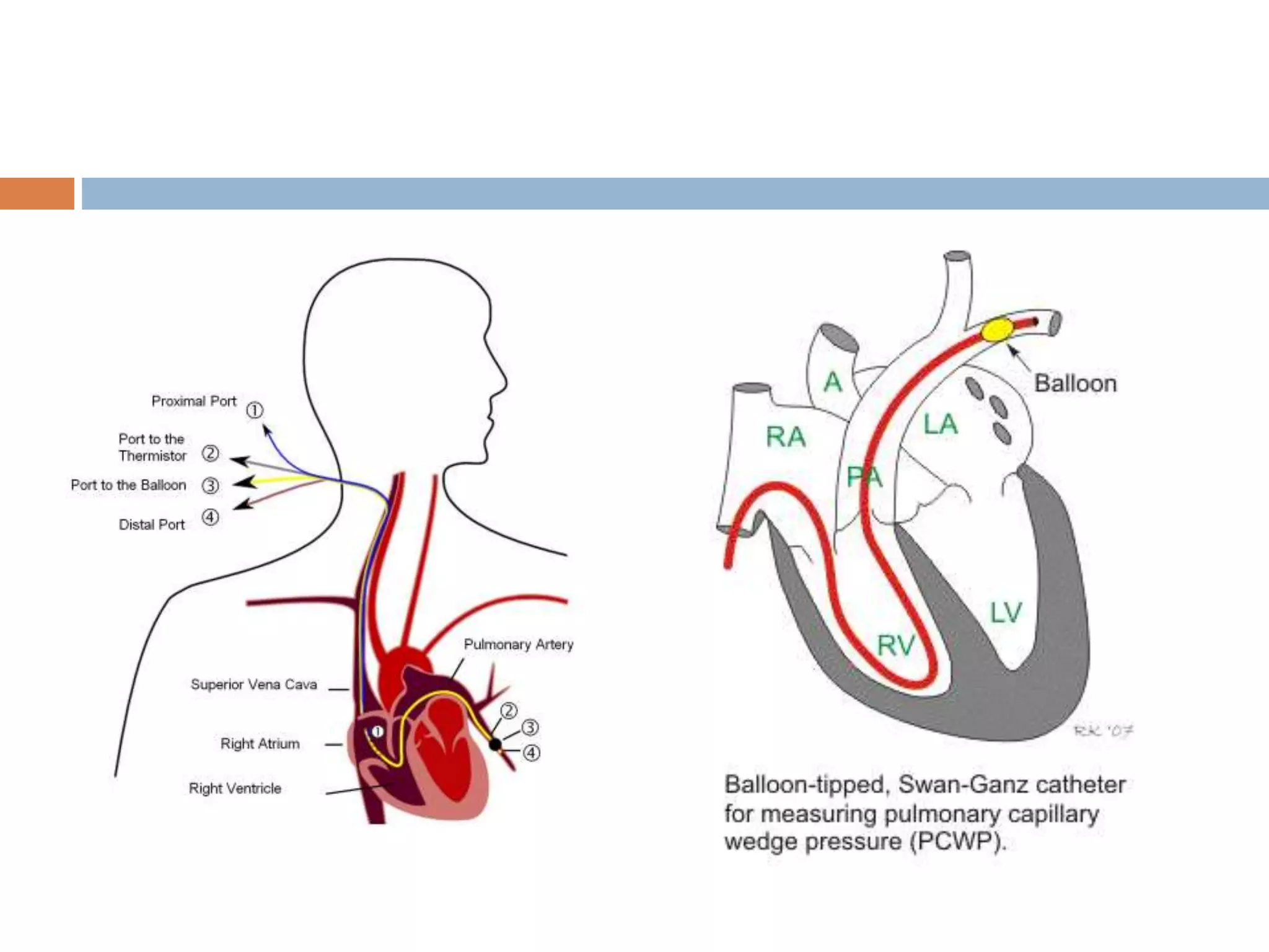 central venous and/or pulmonary occlusion pressure in a hemorrhagic ...