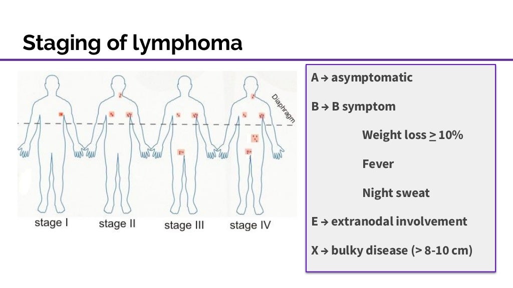 What you need to know about dlbcl