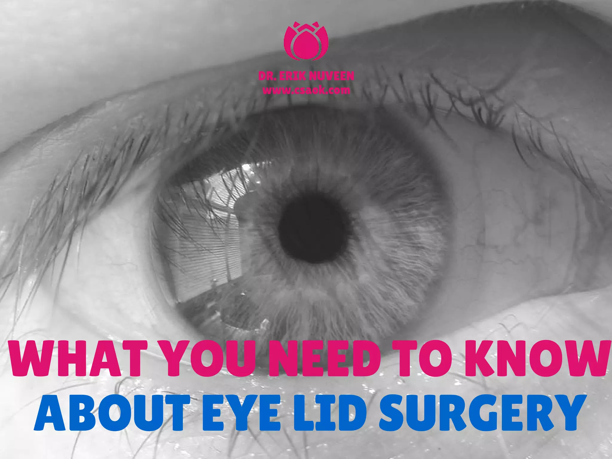 What You Need to Know About Eye Lid Surgery | PDF