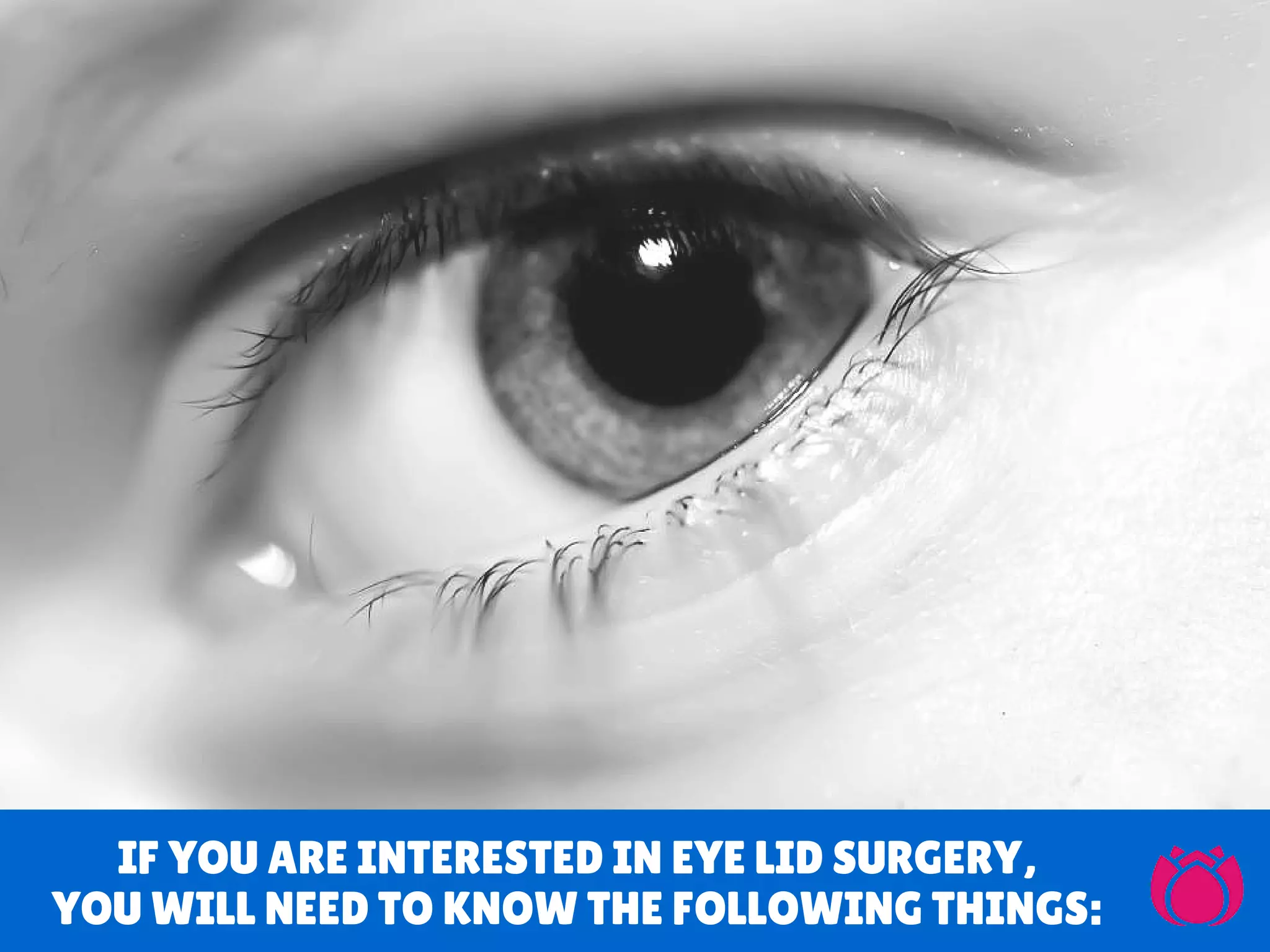 What You Need to Know About Eye Lid Surgery | PDF