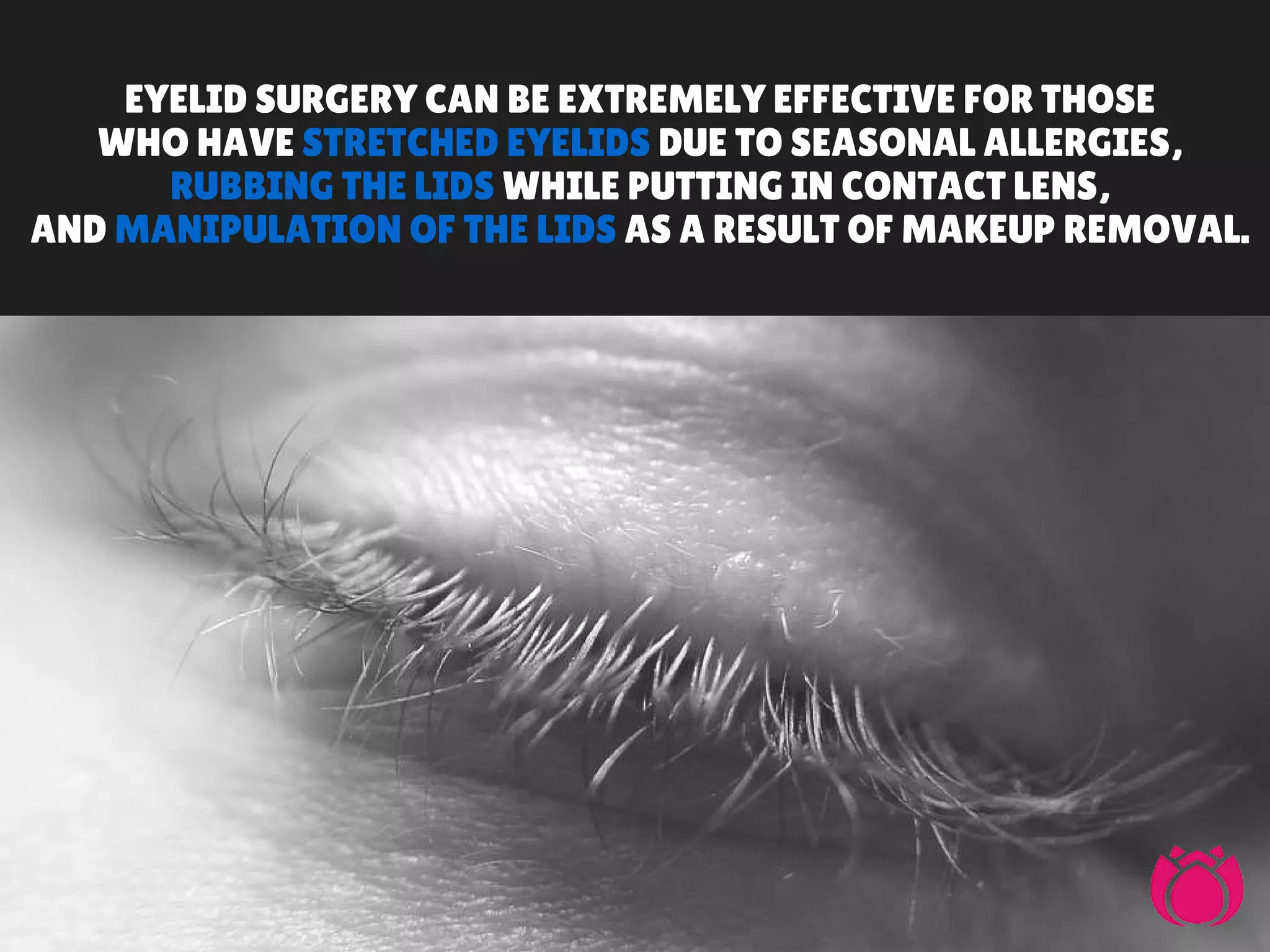 What You Need to Know About Eye Lid Surgery | PDF