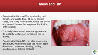 What your mouth says about your health | PPT