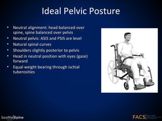 Neuromuscular Scoliosis in Cerebral Palsy - Wheelchair fitting a child ...
