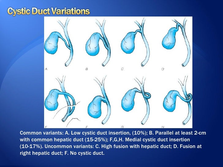 Laparoscopic Gallstone Removal From Common Bile Duct