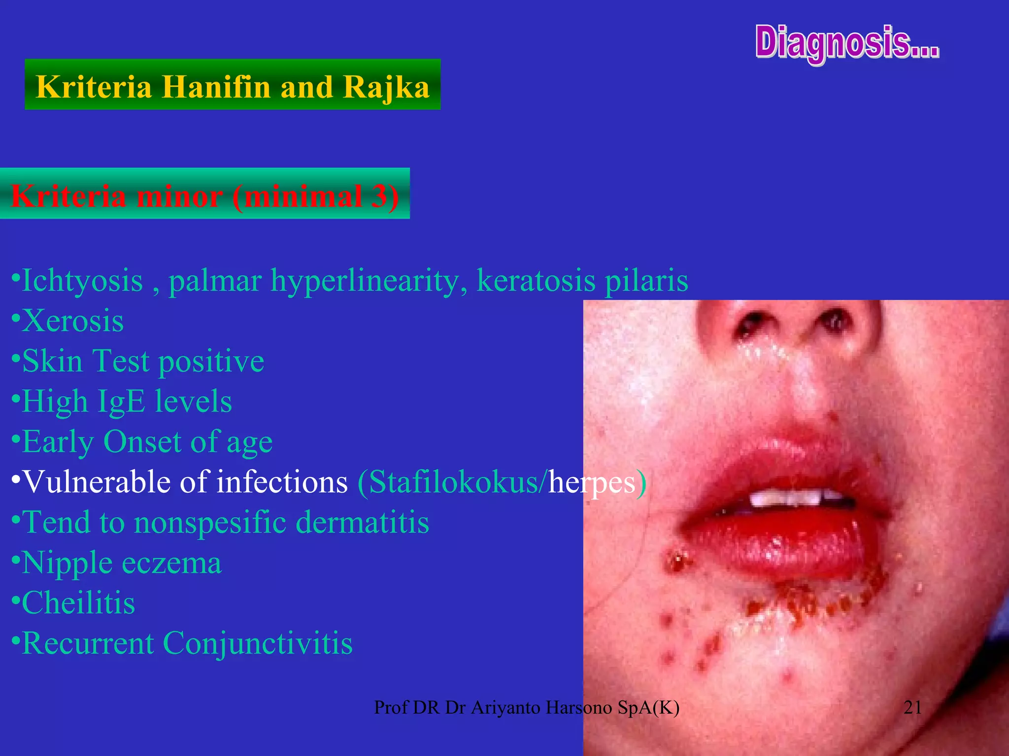 When conventional therapy fails to treat atopic dermatitis | PPT