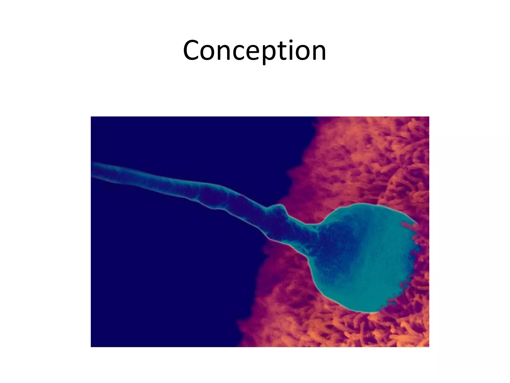 When Does Life Begin | PPT