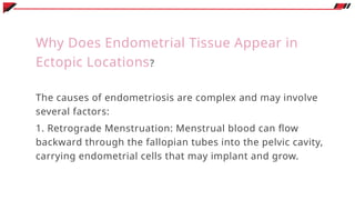 Where Can Endometrial Tissue Go(Wuhan Dr.Lee's TCM Clinic).pptx