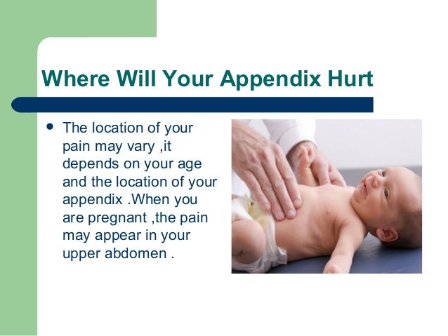 Where Is Your Appendix