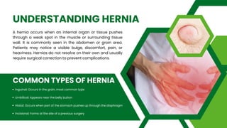 Which is Better for Hernia Open vs Laparoscopic Surgery | PDF