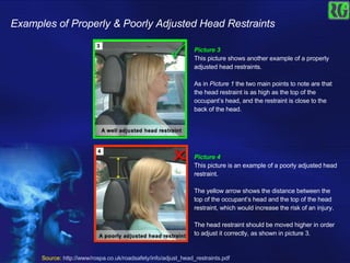 Whiplash Injury | PPS