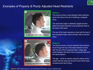 Whiplash Injury | PPS