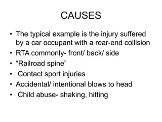 Whiplash injuries | PPT