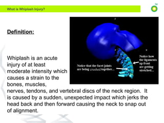 Whiplash injuries[1] | PPS