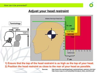 Whiplash injuries[1] | PPS