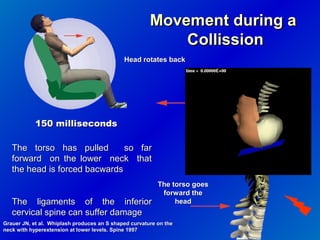 Whiplash: The ocult damages | PPT