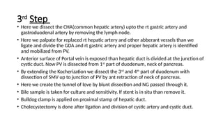 Operative management in patient of pancreatic cancer: Whipple procedure ...