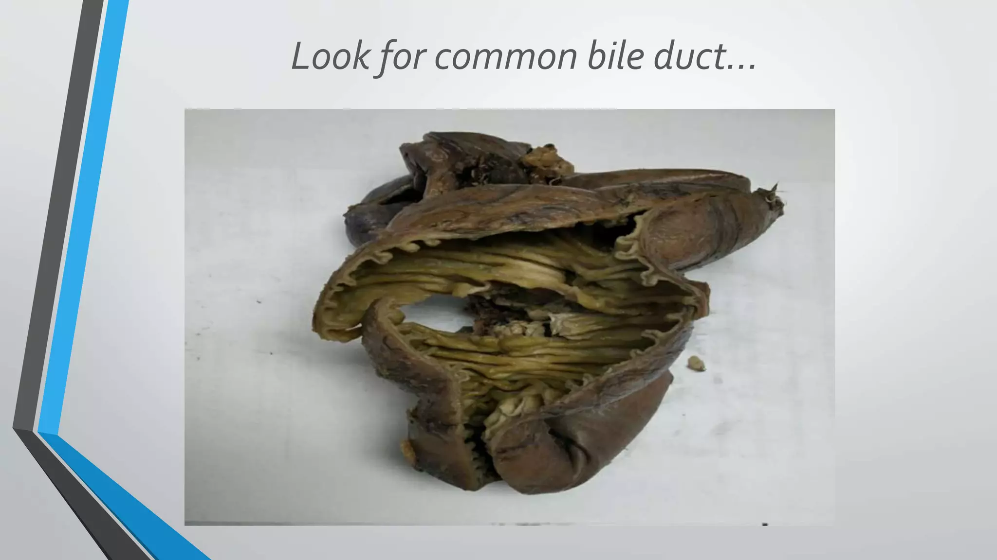 Whipple's specimen grossing | PPTX