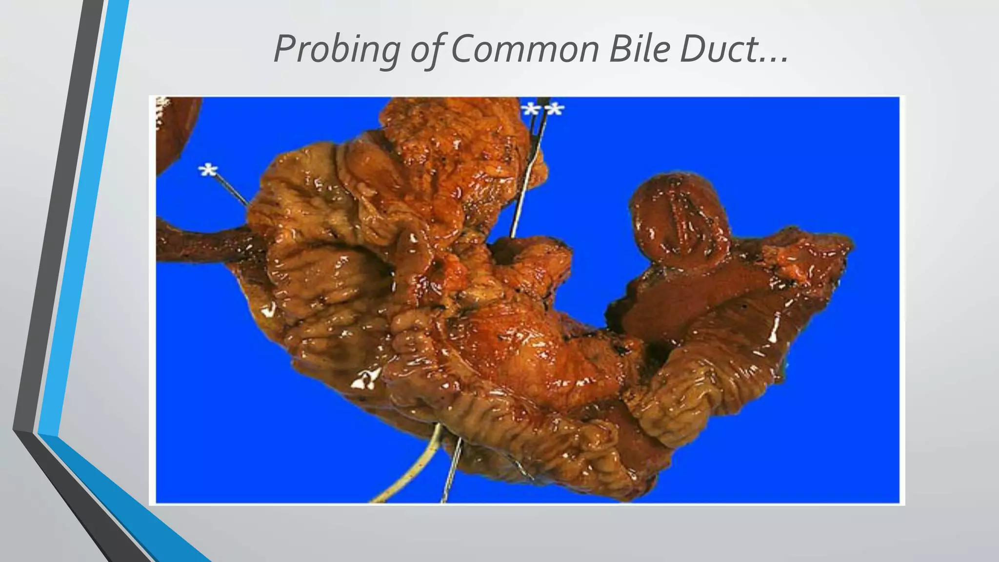 Whipple's specimen grossing | PPTX