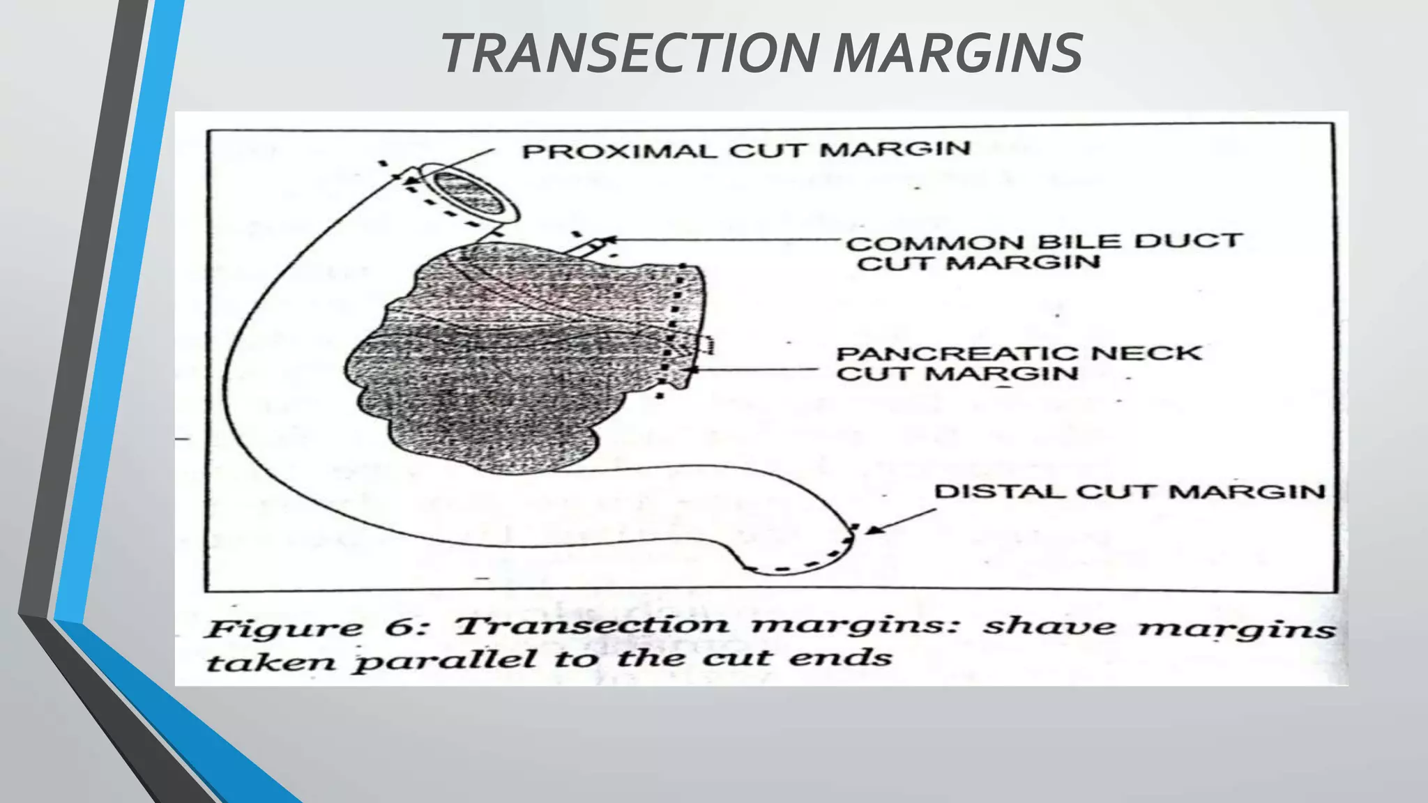 Whipple's specimen grossing | PPTX