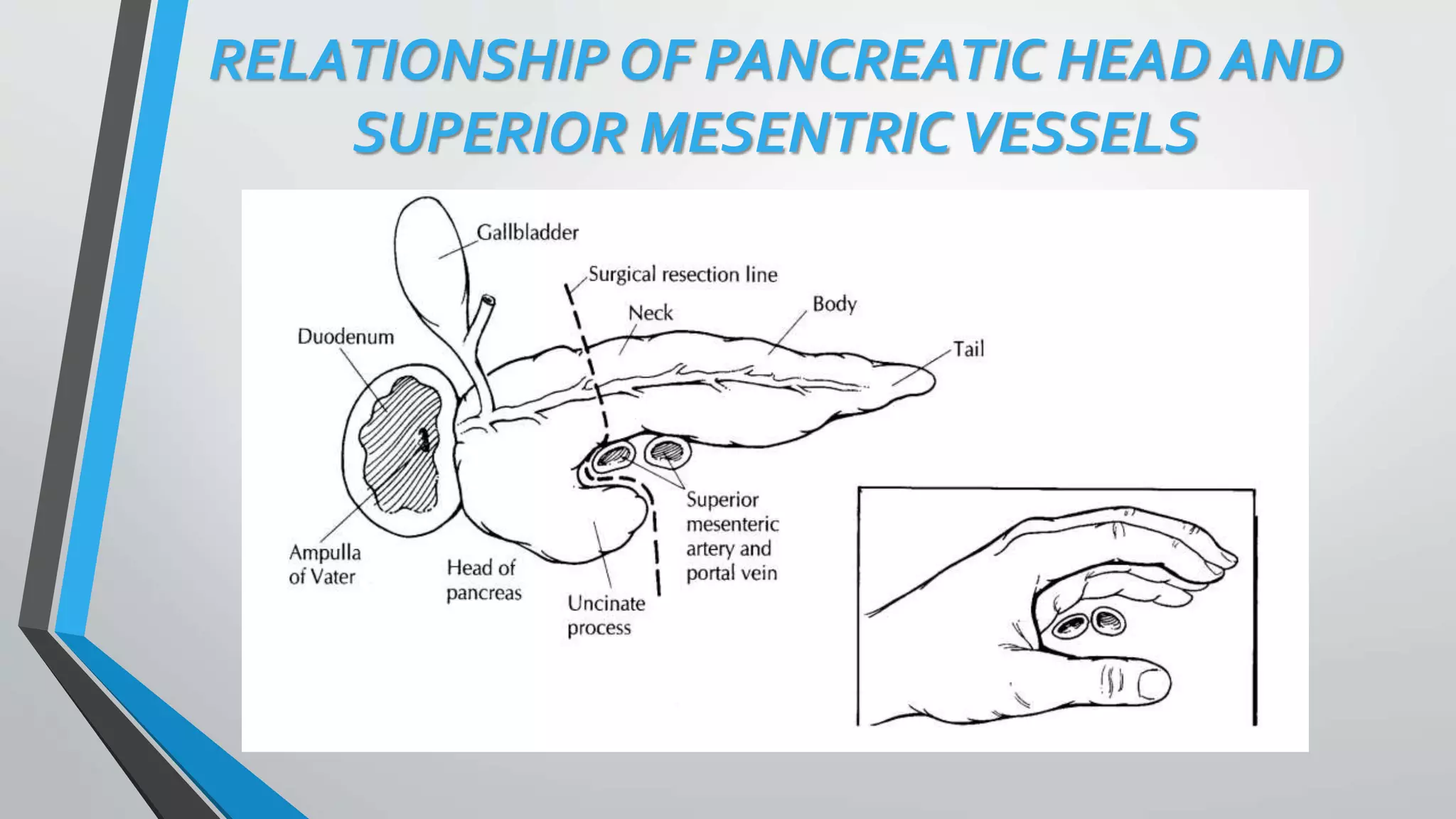 Whipple's specimen grossing | PPTX