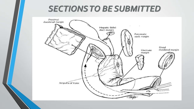 Whipple's specimen grossing