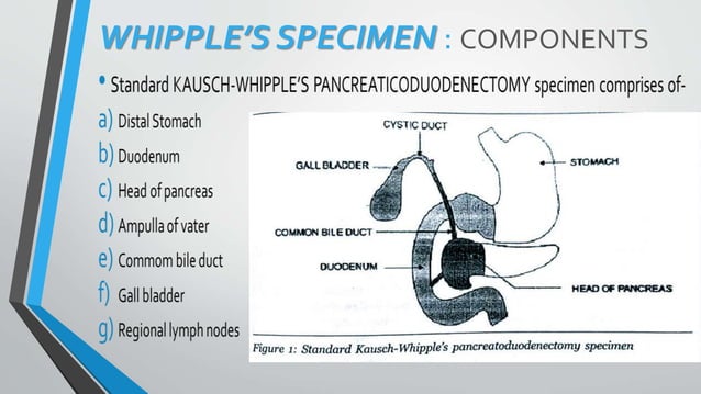 Whipple's specimen grossing