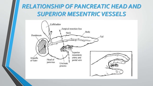 Whipple's specimen grossing