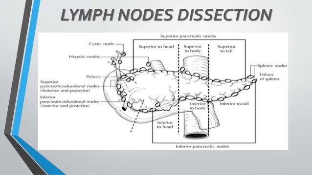 Whipple's specimen grossing