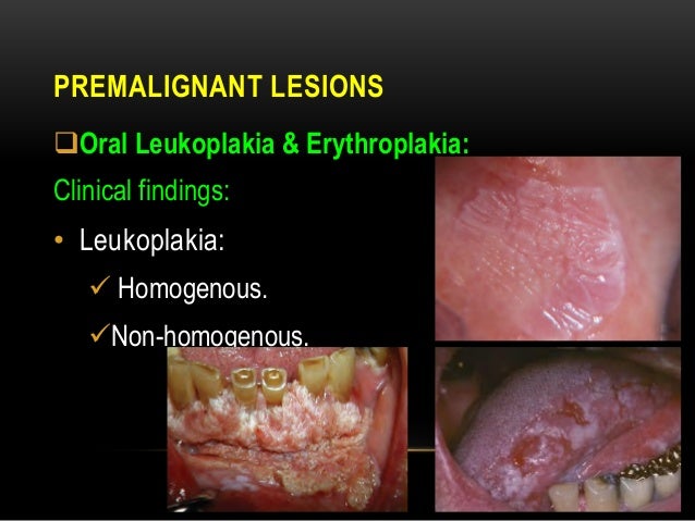 White an dredlesion(1)