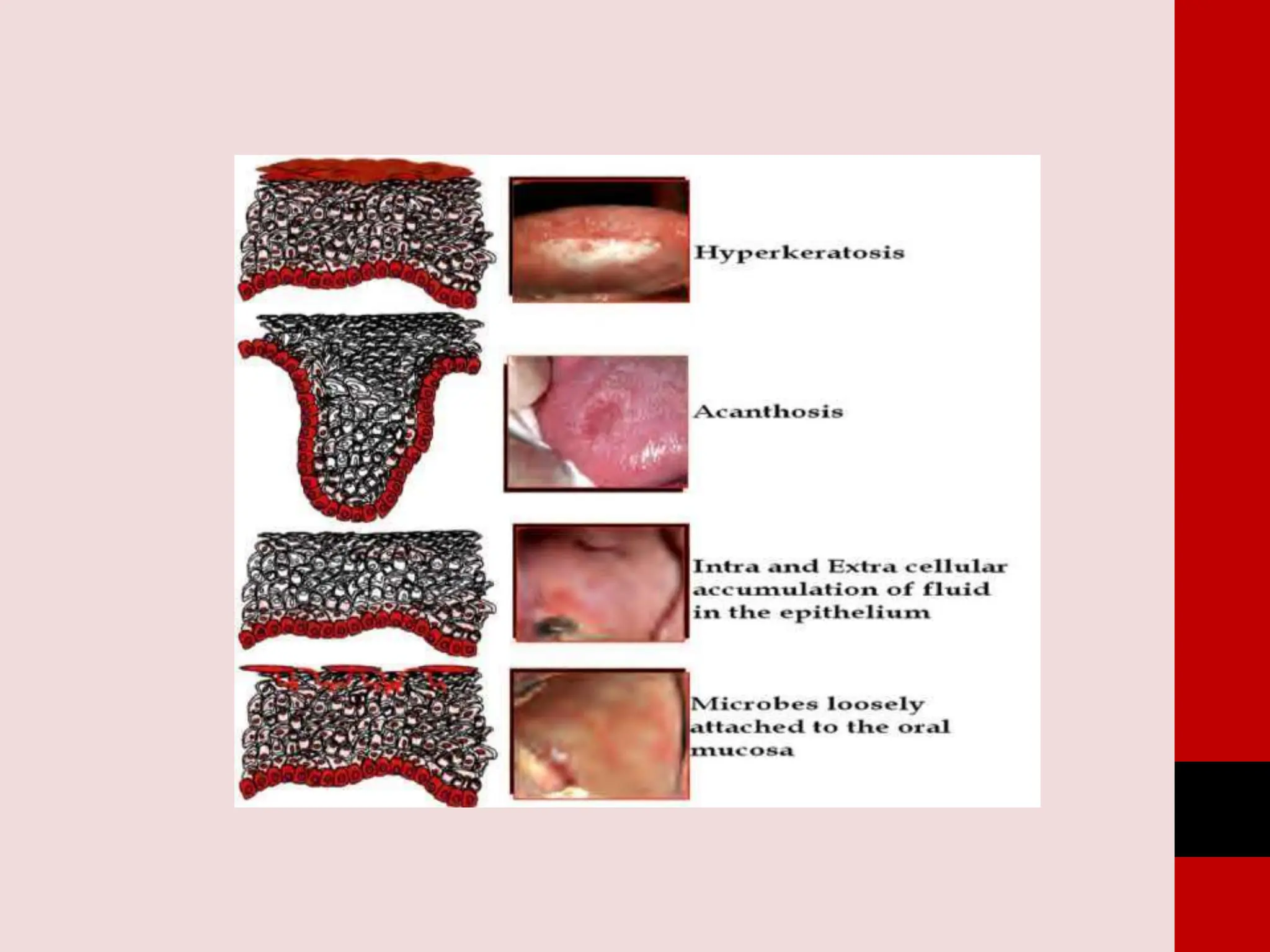 white and red lesions ORAL MEDICINE.pptx
