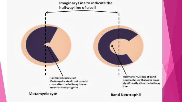 White blood cells [wbc] | PPTX | Blood Disorders | Diseases and Conditions