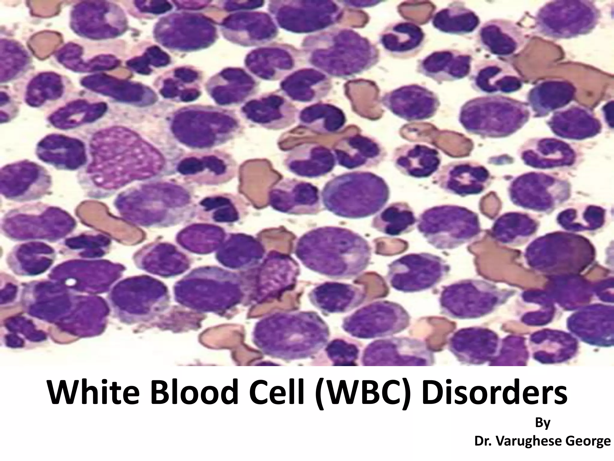 Benign White blood cell (WBC) Disorders | PPTX