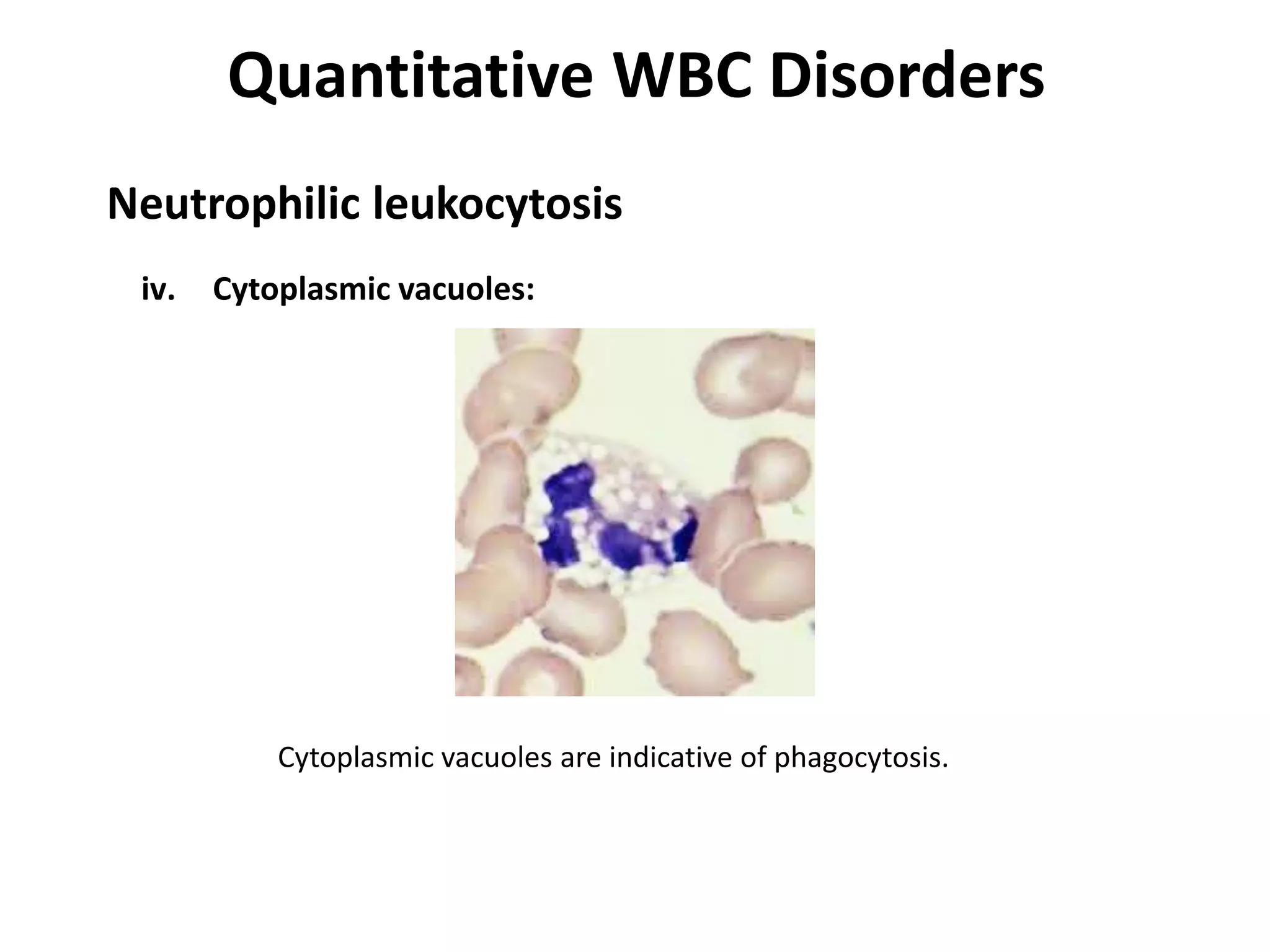 Benign White blood cell (WBC) Disorders | PPTX