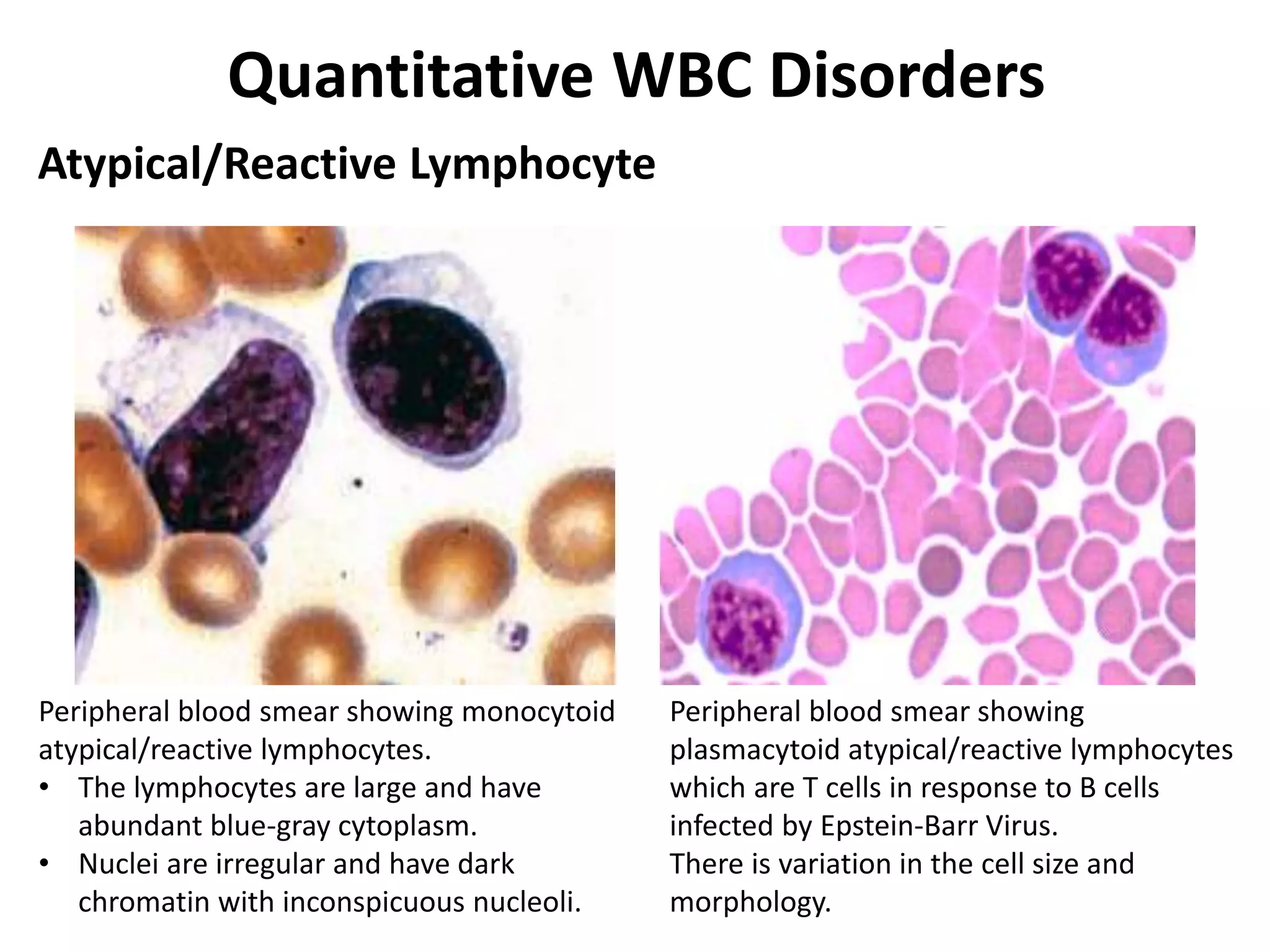 Benign White blood cell (WBC) Disorders | PPTX