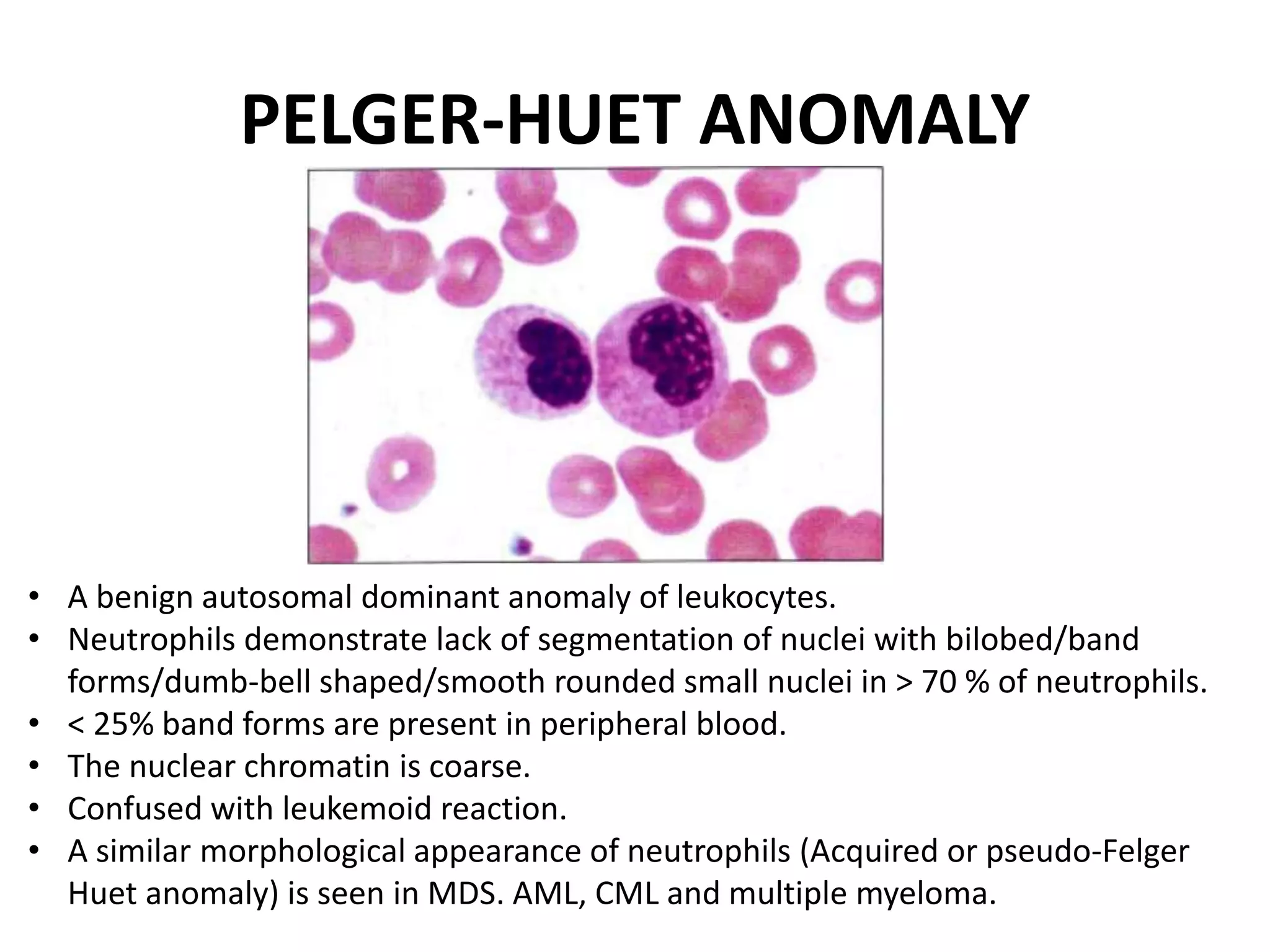 Benign White blood cell (WBC) Disorders | PPTX