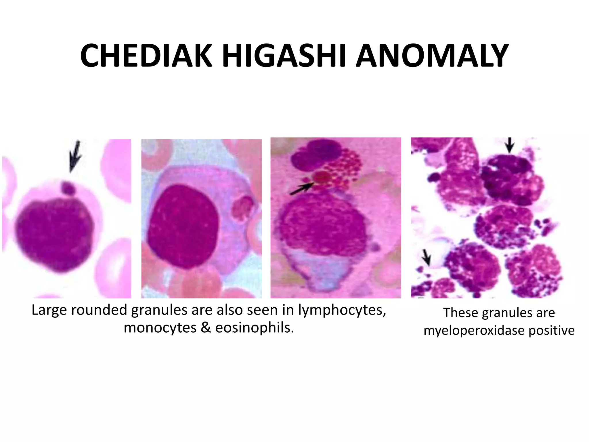 Benign White blood cell (WBC) Disorders | PPTX