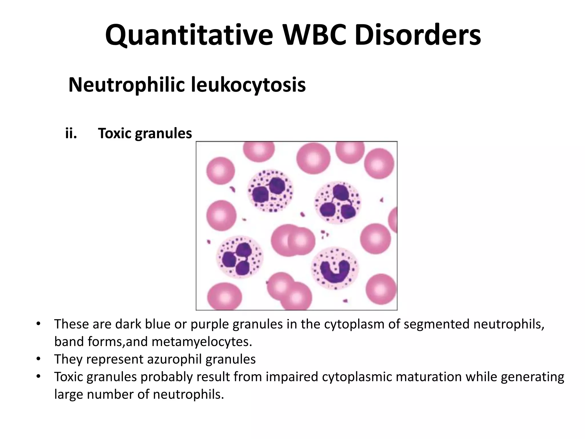 Benign White blood cell (WBC) Disorders | PPTX