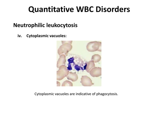 Benign White blood cell (WBC) Disorders | PPTX