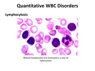 Benign White blood cell (WBC) Disorders | PPTX