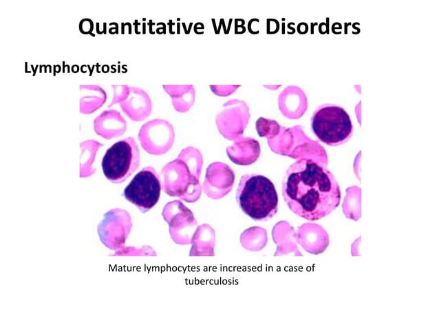 Benign White blood cell (WBC) Disorders | PPTX